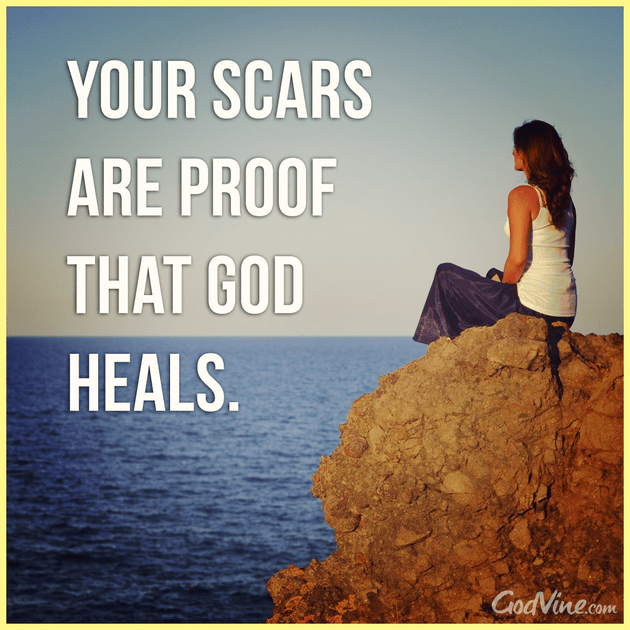 Your Scars are Proof that God Heals - Your Daily Verse | iBelieve.com