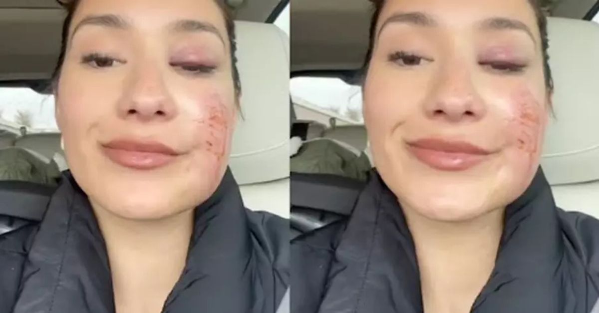 Car Accident on First Date Night without Kids in a Year, Reminds Couple ...